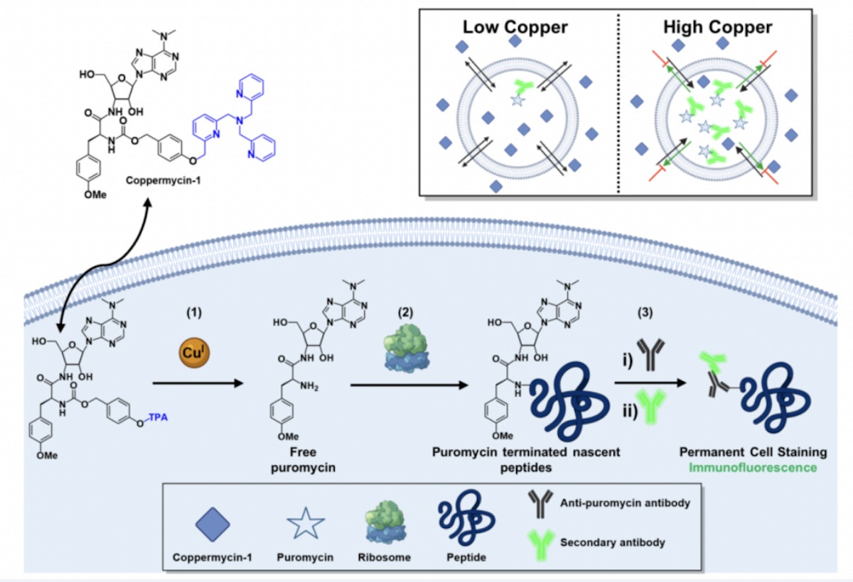 What do copper and lung cancer have in common? | Pulmonary