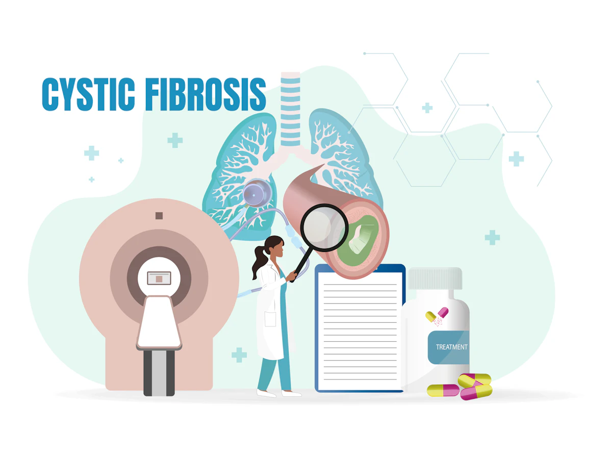 ETI drug reduces CF treatments, improves lung function | Pulmonary